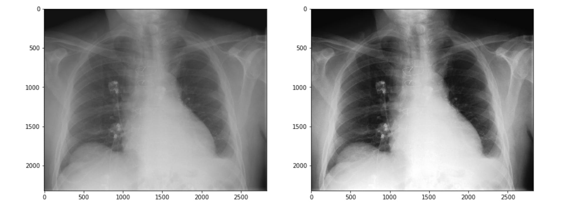 Histogram Equalization in Python from Scratch | HackerNoon