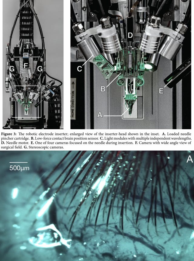 Neuralink, OpenWater, DARPA N3, and Our Future Matrix-Style Immersive ...