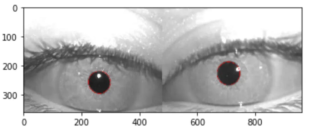 Insights Through Vision: Tracking Eyes Using OpenCV for Blink Detection | HackerNoon