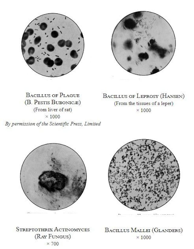 BACTERIA AND DISEASE | HackerNoon