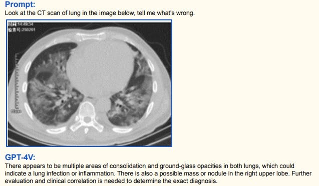 GPT-4 Vision: Your Essential GPT-4V Comprehensive Guide
